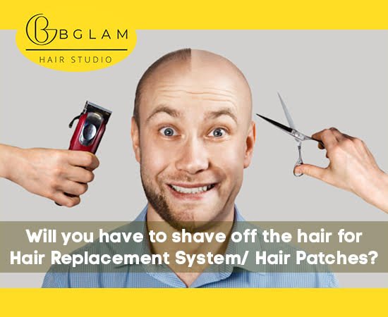 Will you have to shave off the hair for Hair Replacement System/ Hair ...