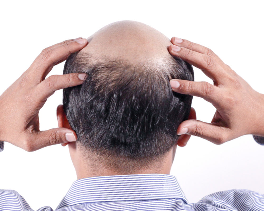 What is Hair Weaving and How Does it Work? - Bglam Hair Studio