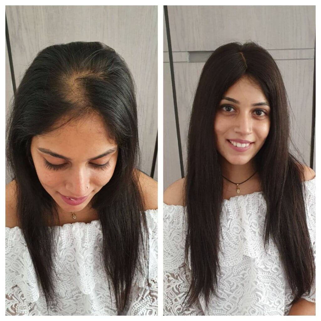 Best Hair Bonding services in Hyderabad | Hair Fixing in Hyderabad